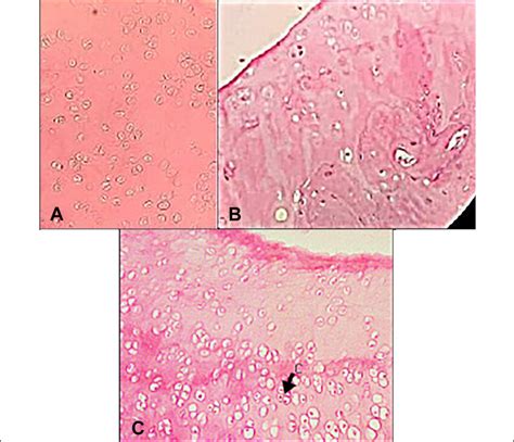 Photomicrograph Of A Histological Section Of Articular Cartilage