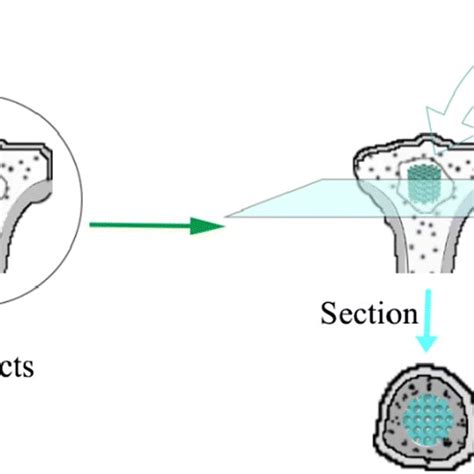 Repair Of Bone Defects Using Bone Tissue Engineering Scaffolds
