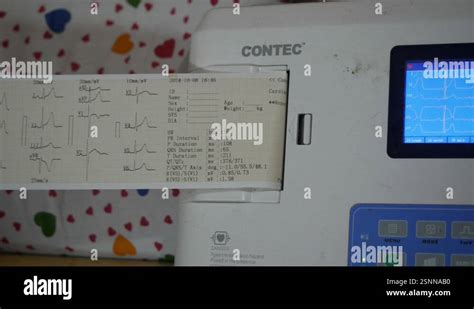 Ecg Machine Display And Print Out Chart Indicating Heart S Electrical Activity Stock Video