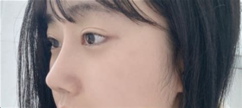 시술 수술 질문 이런 코하고 싶은데 강남언니 1등 성형수술and피부시술 정보앱