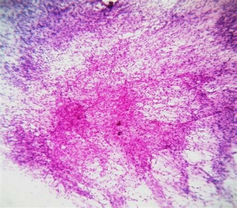 A Tissue Culture Like Proliferating Fibroblasts B Abundant