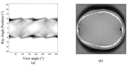 A A Synthetic 360 View Projection Of The Central Slice Generated