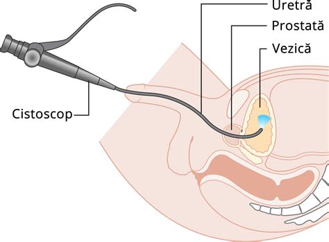 Cabinet De Urologie Doctor George Mitroi Cabinet Medical Craiova
