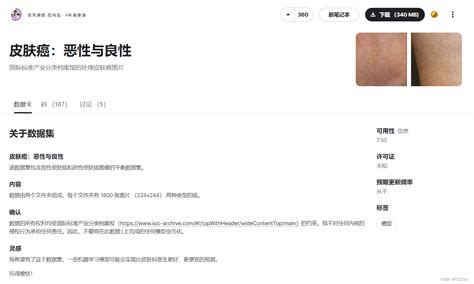【数据集】全网最全的常见已公开医学影像数据集医学图像公开数据集 Csdn博客