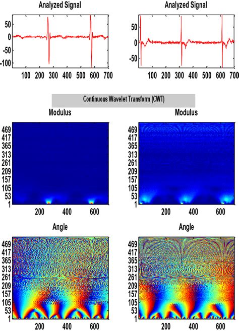 cwt analysis of mit bih arrhythmia database record no 103 m download scientific diagram