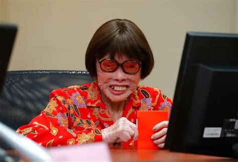 曾多次來台！「穿山甲人」離世 74歲張四妹於大馬病逝 東南亞新聞 四方報 Nownews今日新聞