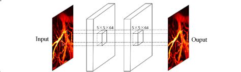 Structure Of Motion Correction Based On Convolutional Neural Network