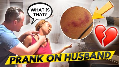 Hickey Prank On Husband Big Mistake Youtube