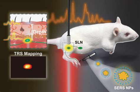 Schematic Illustration Of The Non‐invasive Detection And Depth