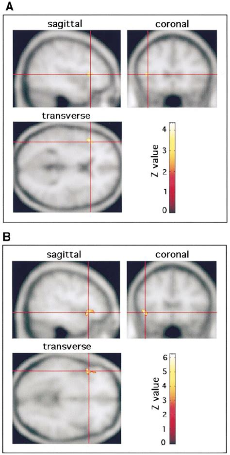 Selective Activation Associated With Syntactic And Semantic Processing