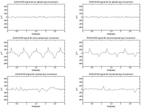 typical eog signals recorded for three situations described in the