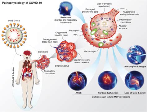 Pathophysiology Of Sars Cov 2 Systemic Infection Infection Initiates