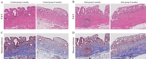 Hande And Massons Trichrome Staining Of Common Bile Ducts Cbd From The