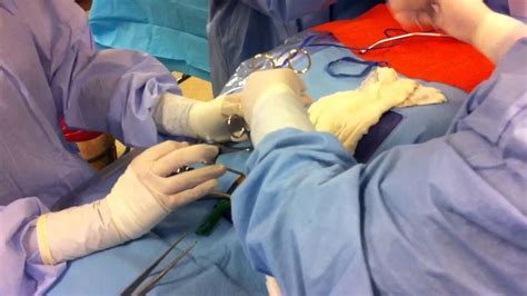 Mock Open Cholecystectomy Part 2 YouTube