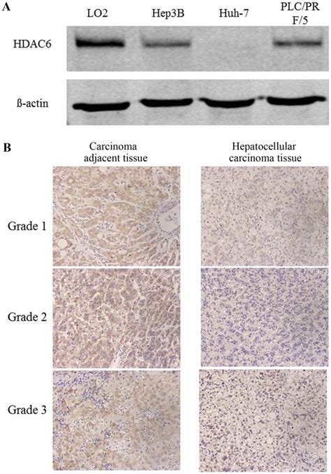 Overexpression Of Hdac6 Suppresses Tumor Cell Proliferation And