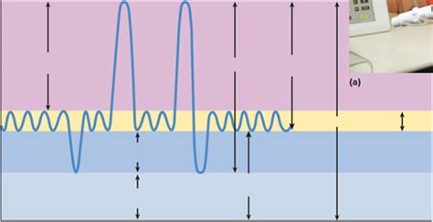 Spirometer Diagram Quizlet Spirometer Diagram Quizlet