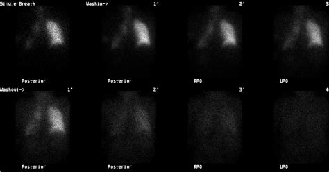 MIR Teaching File Case Vq022