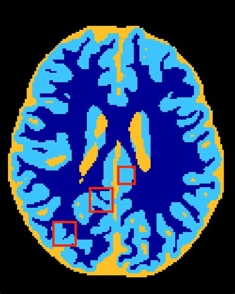 Comparison Of The Segmentation Results Achieved By The Baseline And Download Scientific Diagram