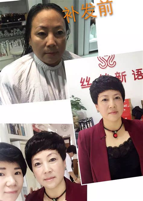 对比效果 杭州萧山丝丝新语假发店
