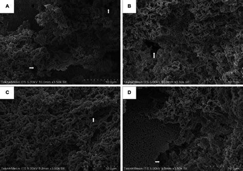 Examination Of The Structure And Formation Streptococcus Mutans Biofilm Induced By Glucose