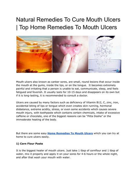 Ppt Natural Remedies To Cure Mouth Ulcers Top Home Remedies To