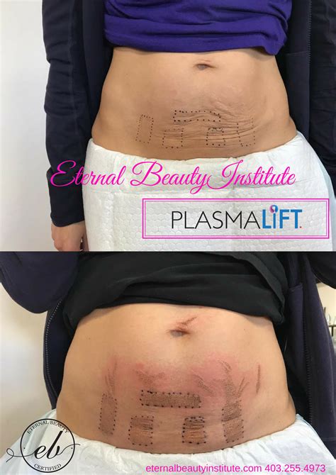 Simple Trick To Remove Brown Spots From Your Skin Artofit