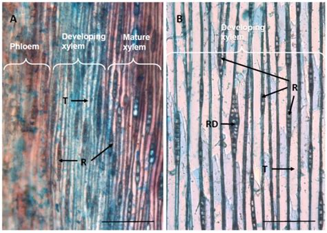 Tracheids Under Microscope