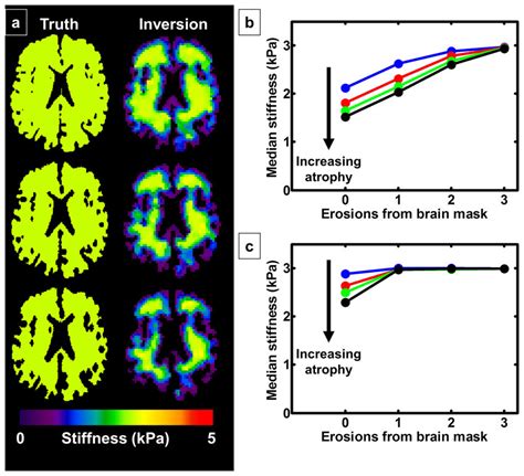 Finite Element Model FEM Simulations A The True Stiffness Maps Download Scientific Diagram
