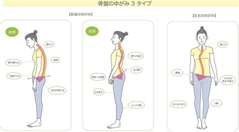 【反り腰さん必見】ガチガチな前ももを無理なく伸ばすストレッチ（上村ゆい） エキスパート Yahooニュース
