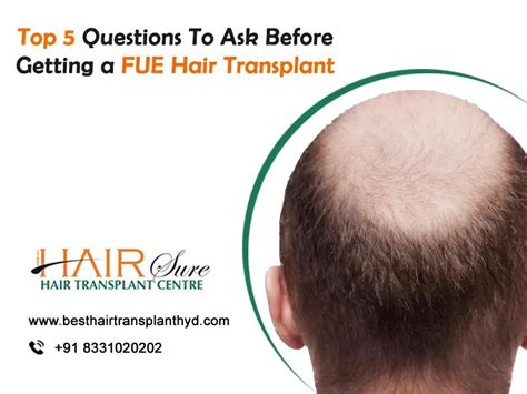 Top 5 Questions To Ask Before Getting An Fue Hair Transplant Cyber