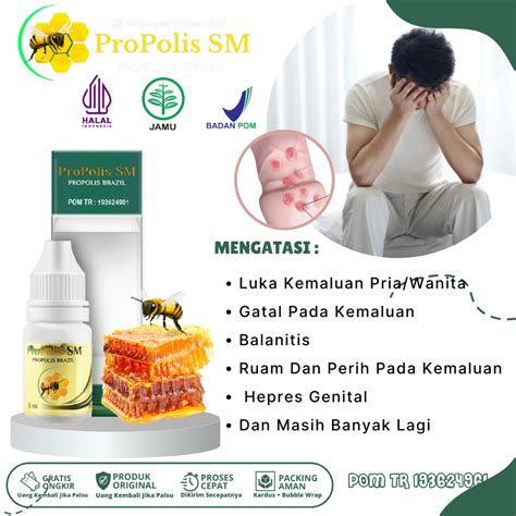 Jual Obat Luka Kemaluan Salep Luka Lecet Di Kemaluan Obat Balanitis