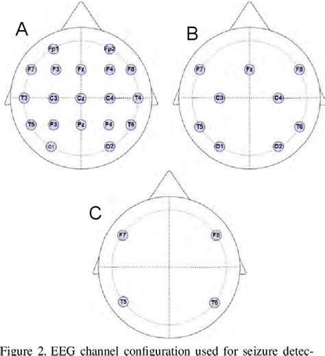 Figure 1 From Seizure Detection Using Time Delay Neural Networks And