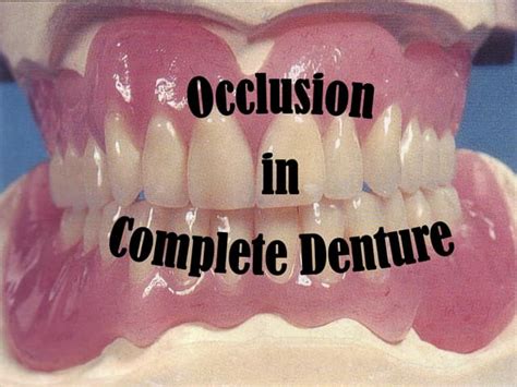 Occlusion In Complete Denture Basic Concept Pdf