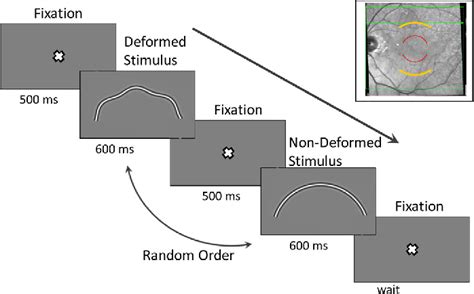 Figure 2 From Scotopic Contour Deformation Detection Reveals Early Rod