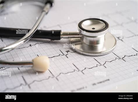 Stéthoscope sur ECG d électrocardiogramme onde cardiaque crise cardiaque rapport de