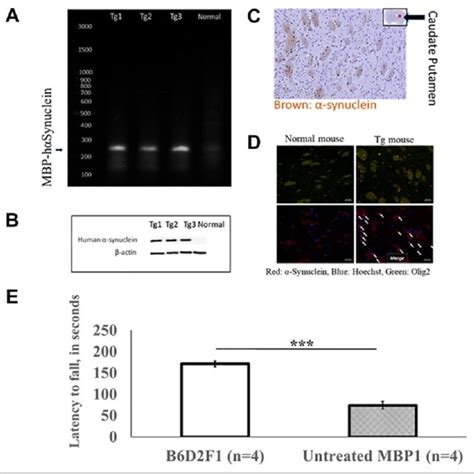 Establishing 12 Week Old Msa Transgenic Tg Mouse Model A Human