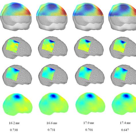 Scalp Eeg And Cortical Potentials At Four Time Instants Approximately Download Scientific