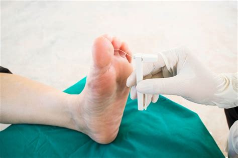 An Overview Of Diabetic Peripheral Neuropathy Endocrinology Advisor