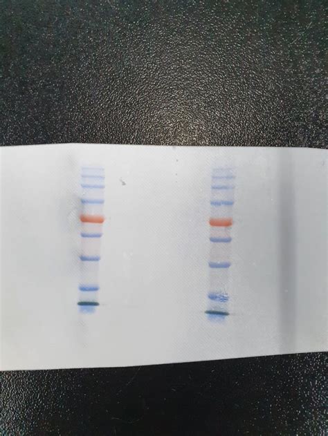 What Is Wrong With My Western Blot Transfer System Smearing Is