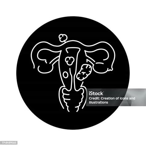 Uterine Myoma Color Line Icon Gynecology Problem Stock Illustration