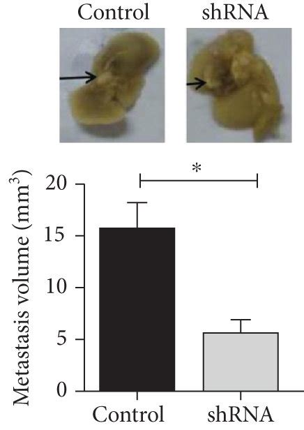 KIF2A Promotes Tumor Growth And Metastasis Of Osteosarcoma In Mice A