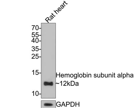 Hemoglobin Subunit Alpha Recombinant Rabbit Monoclonal Antibody Pd00