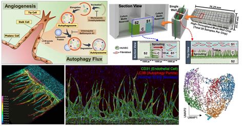 올간칩 기술과 단일세포 Rna 시퀀싱 기술 융합을 기반으로 혈관 신생 시 오토파지의 선택적 제어 기전 규명 연구성과 연구 서울대학교