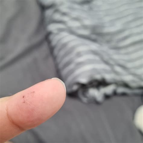 손가락에 검은 자국이 생겼는데 안지워져요 지식in