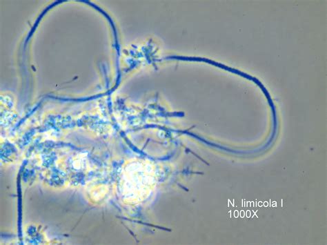 Filamentous Bacteria Gallery 4g Environmental Corporation