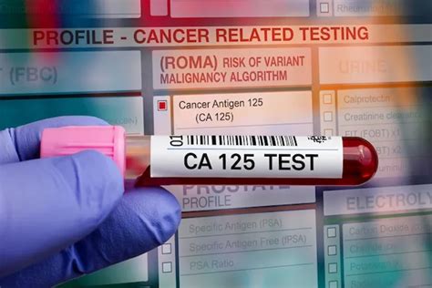 Ca 125 Normal Range In Women Explained