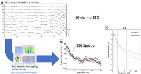 The Processing Procedure Of Transformation The Eeg Tracing Panel A Of Download Scientific
