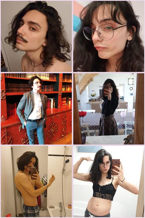 21 Mtf Pre Transition 5 Month Hrt R Transtimelines