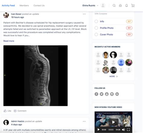 Ultrasound Guided Axillary Brachial Plexus Block NYSORA