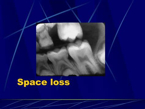 Ppt Tooth Eruption Powerpoint Presentation Free Download Id1716126